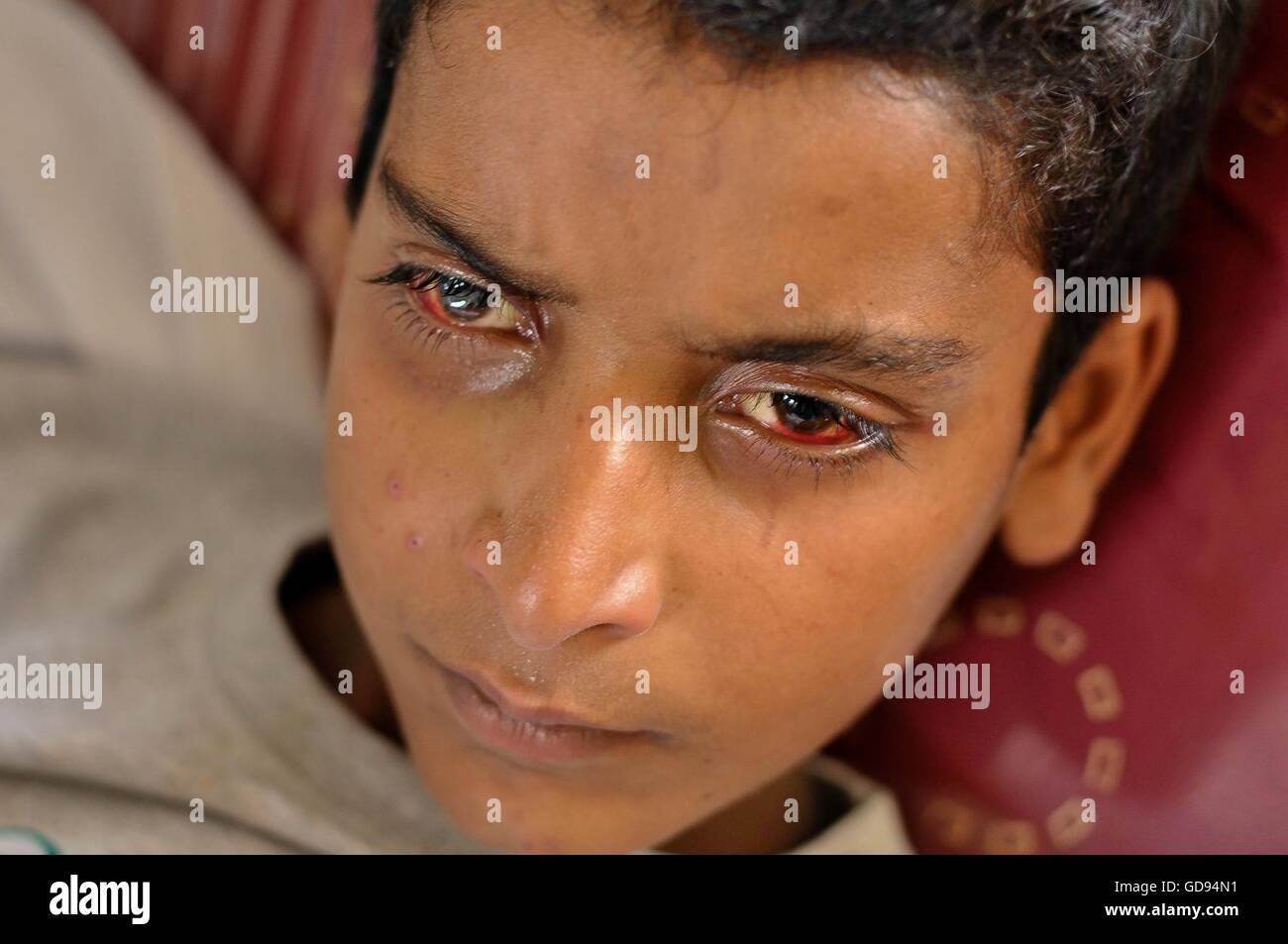 Pellets create havoc in Indian Kashmir Stock Photo - Alamy