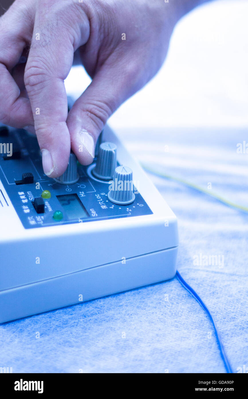 Dry needling electroacupunture machine connected to needles used by ...