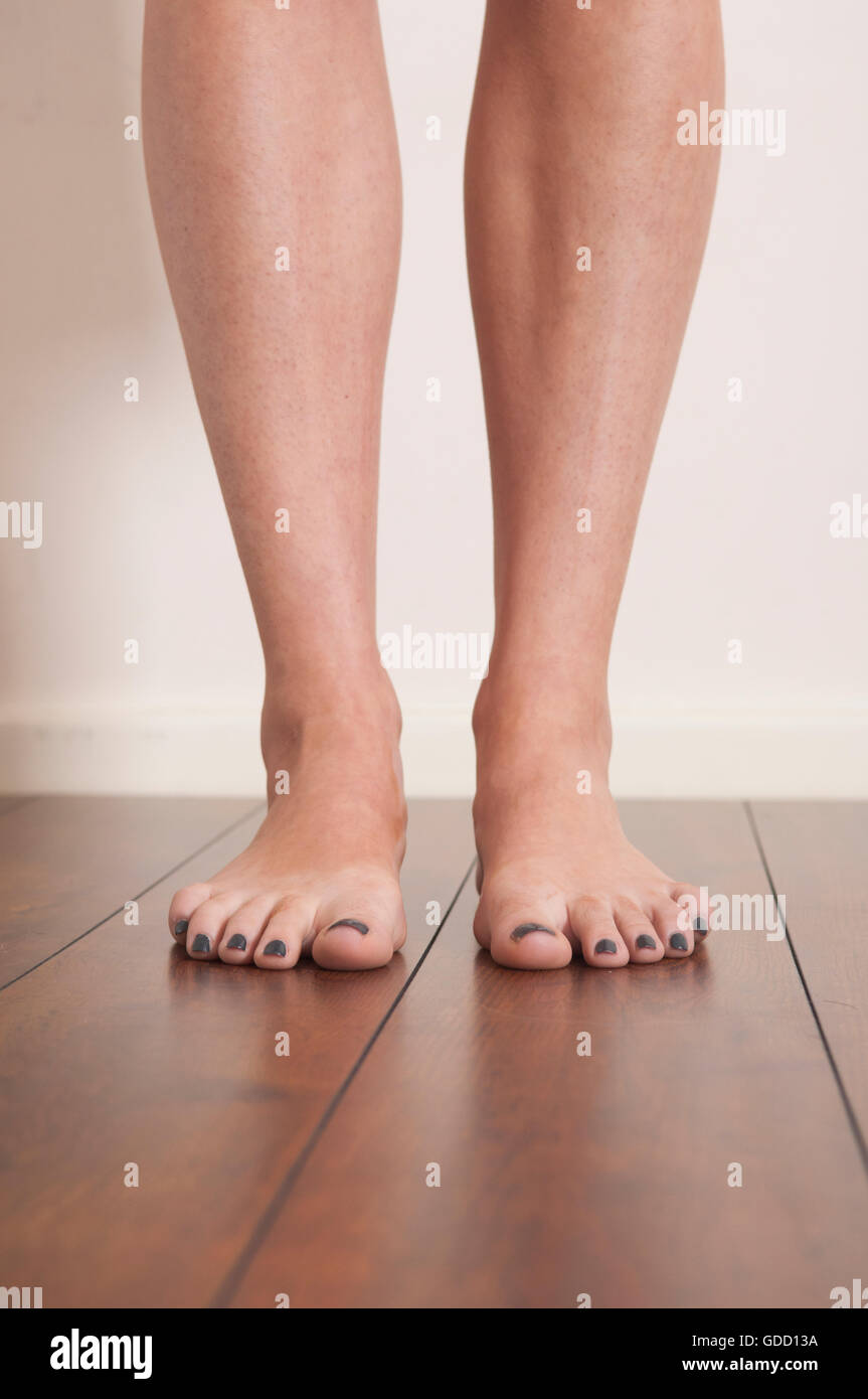 Orthotics transition : r/BarefootRunning