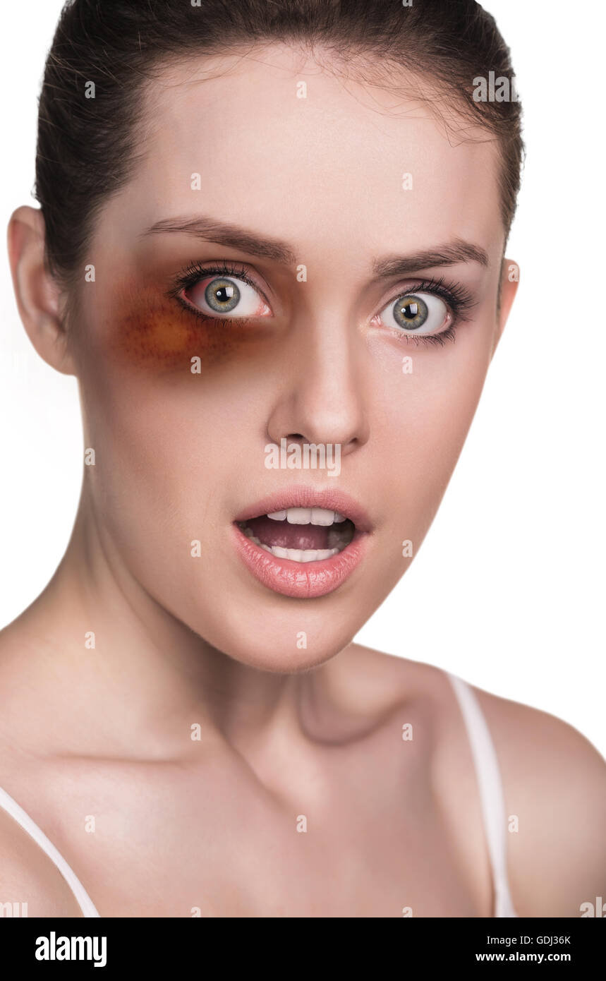 Beaten woman face isolated on white. Domestic violence concept Stock ...