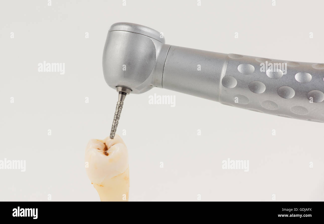 dentist using dental turbine handpiece for dental treatment Stock Photo ...