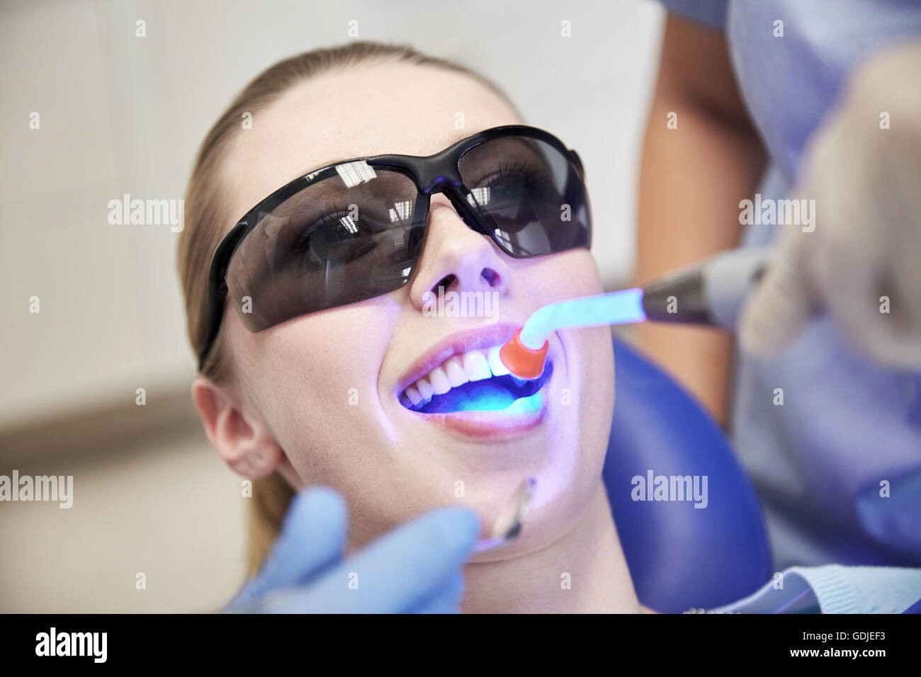 close up of woman patient with dental curing light Stock Photo - Alamy