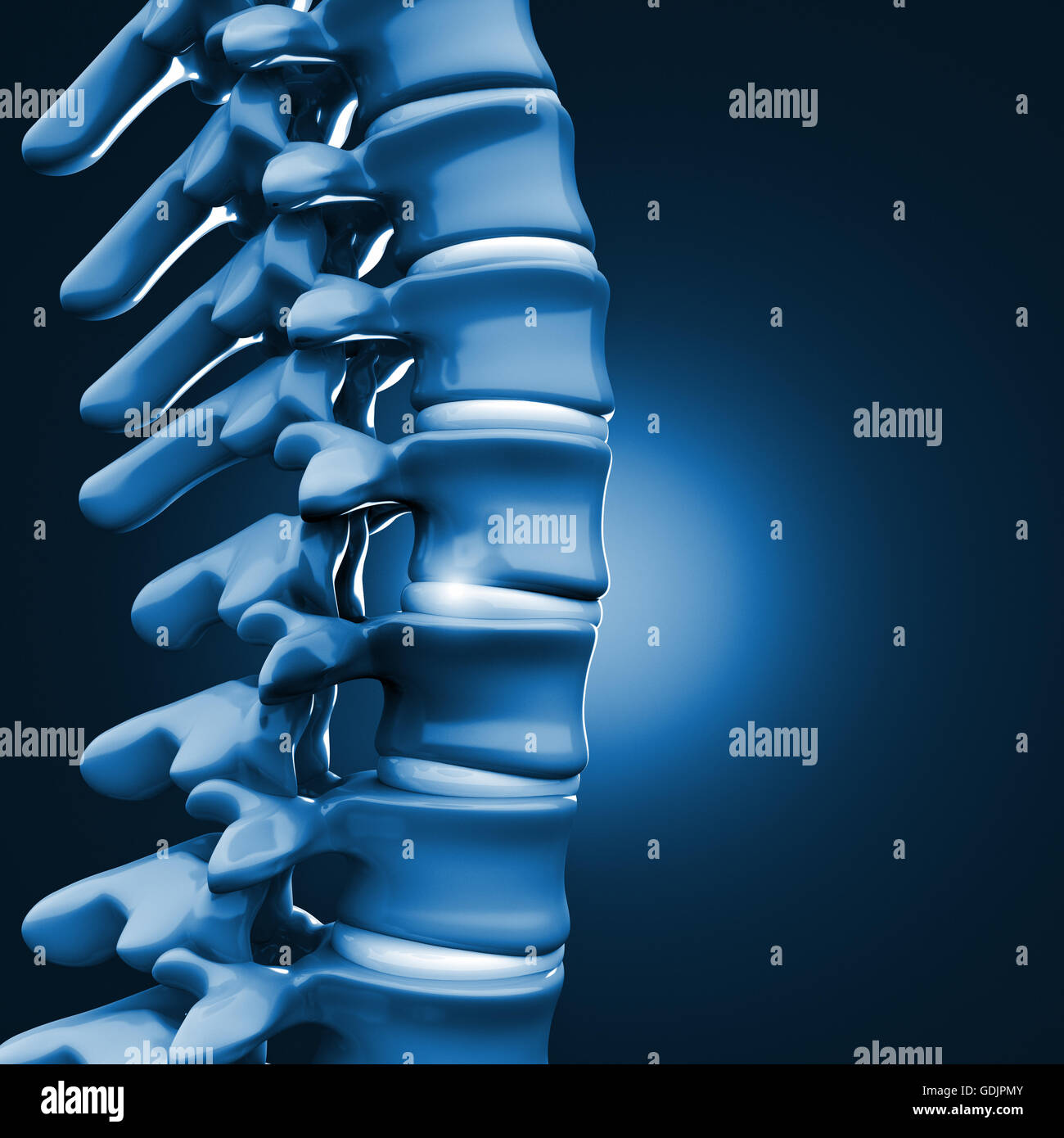 3d image of Herniated disk human spinal Stock Photo - Alamy