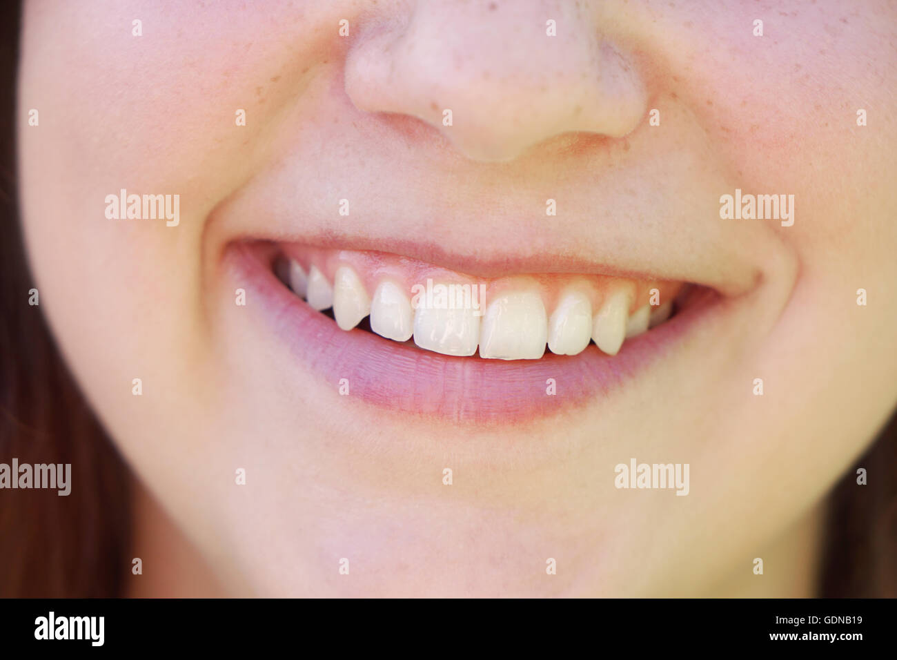 perfect white teeth Stock Photo - Alamy
