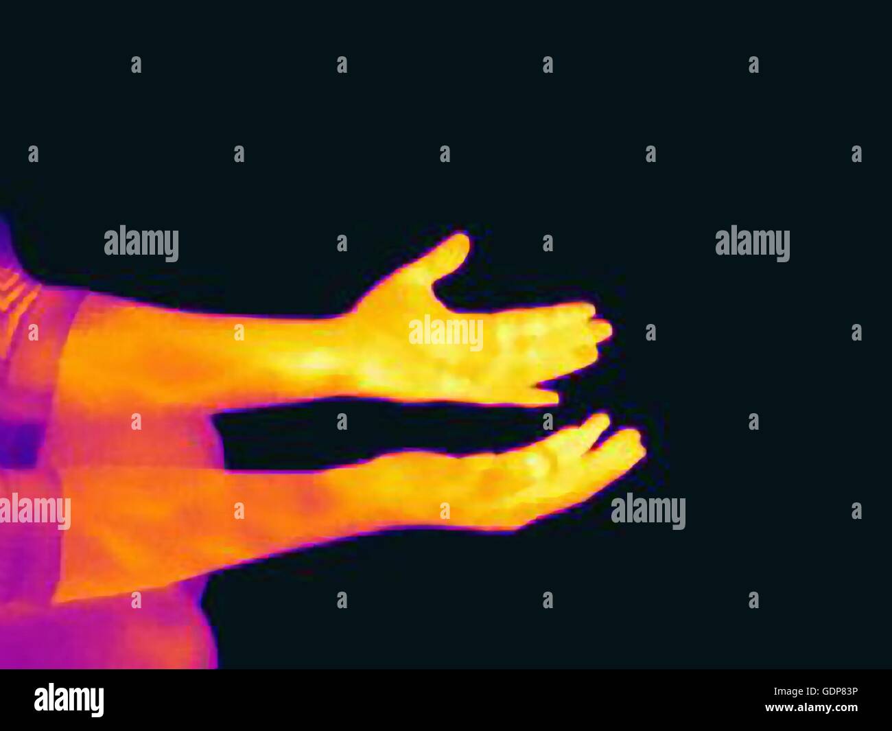 Thermal image of woman's open hand palms Stock Photo - Alamy