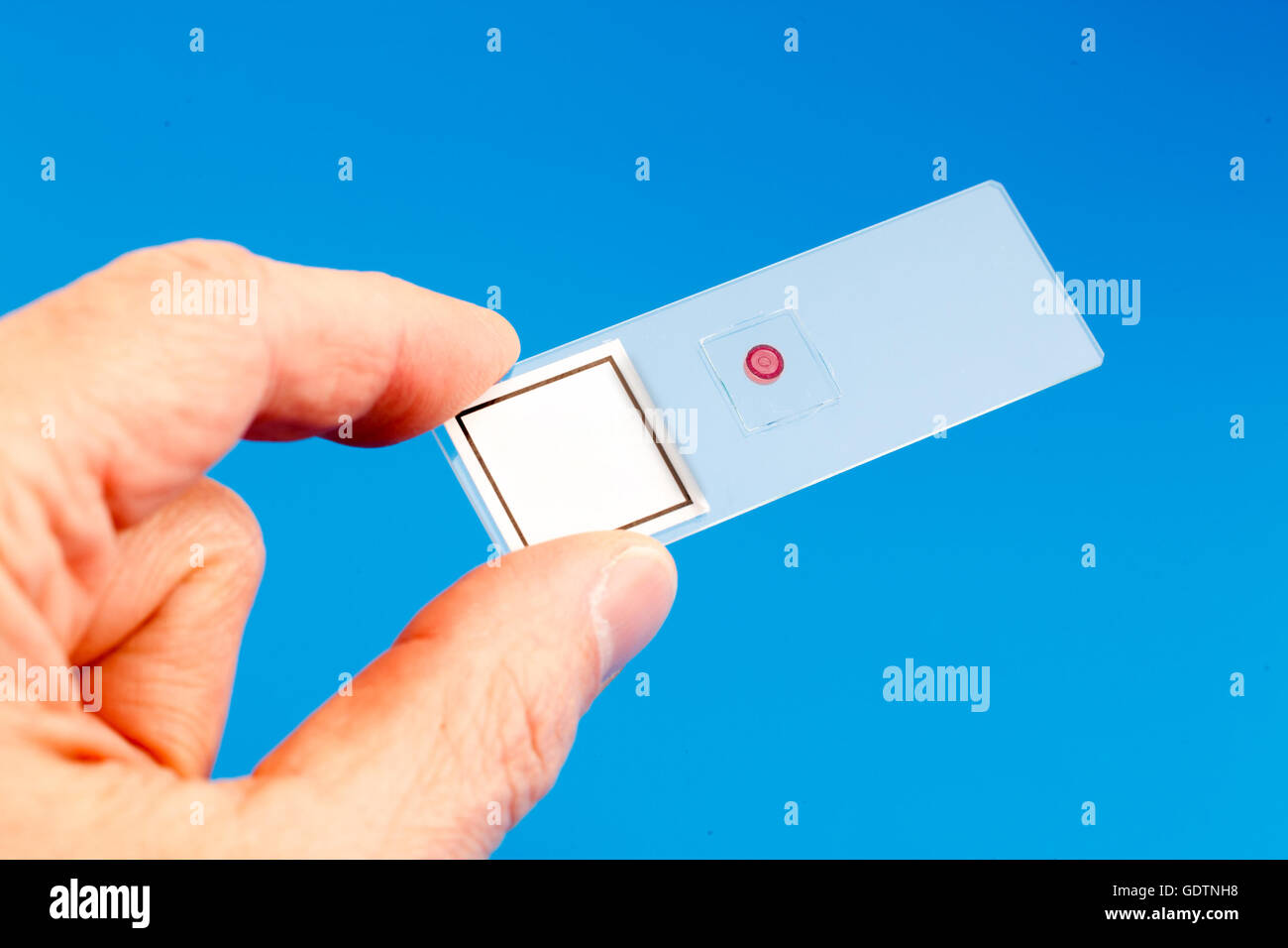 Hematology slide hi-res stock photography and images - Alamy