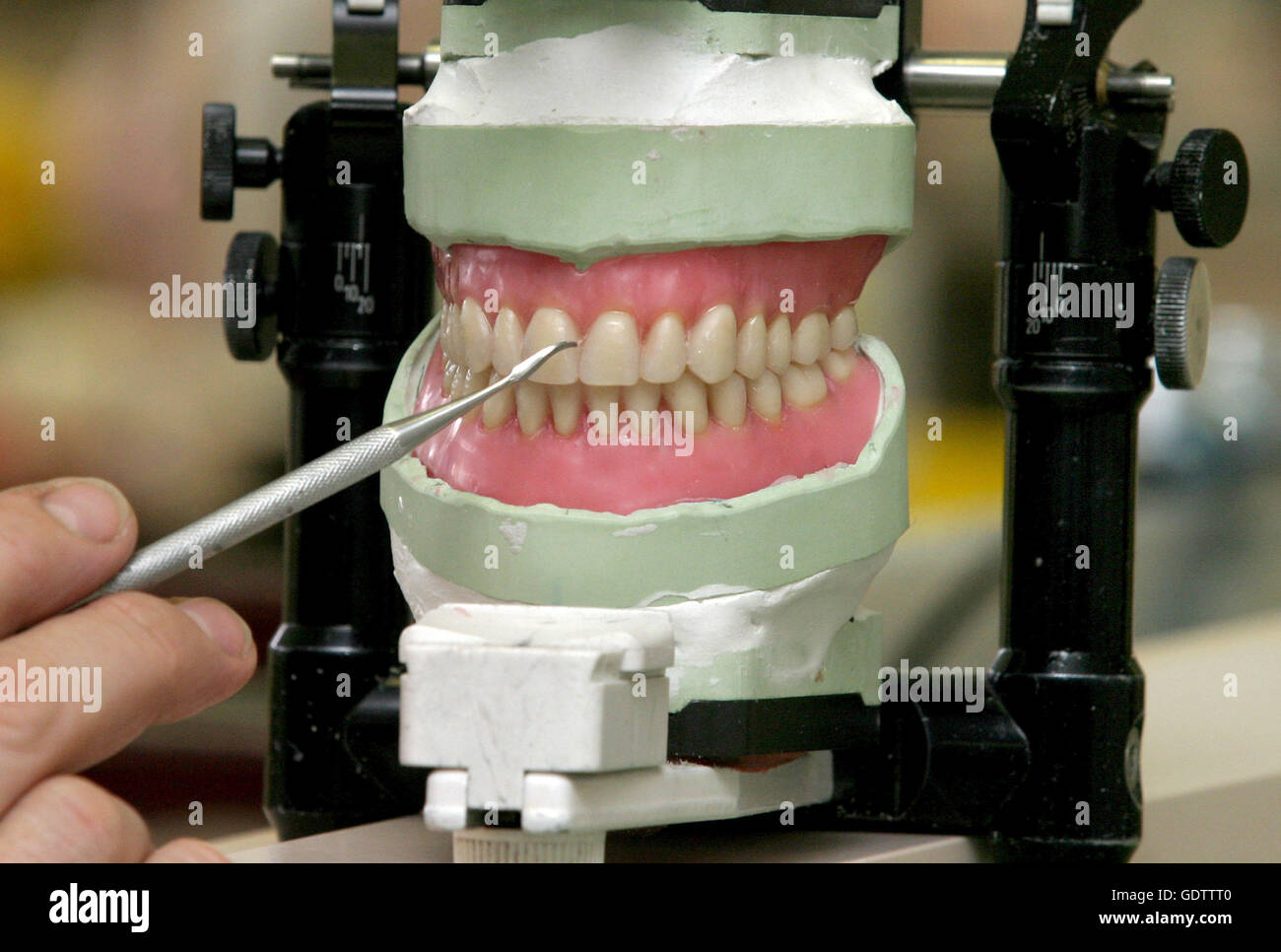 Dentures in a dental laboratory Stock Photo - Alamy