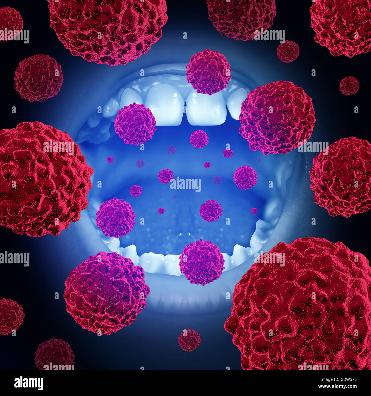 Oral cancer gums tongue hi-res stock photography and images - Alamy