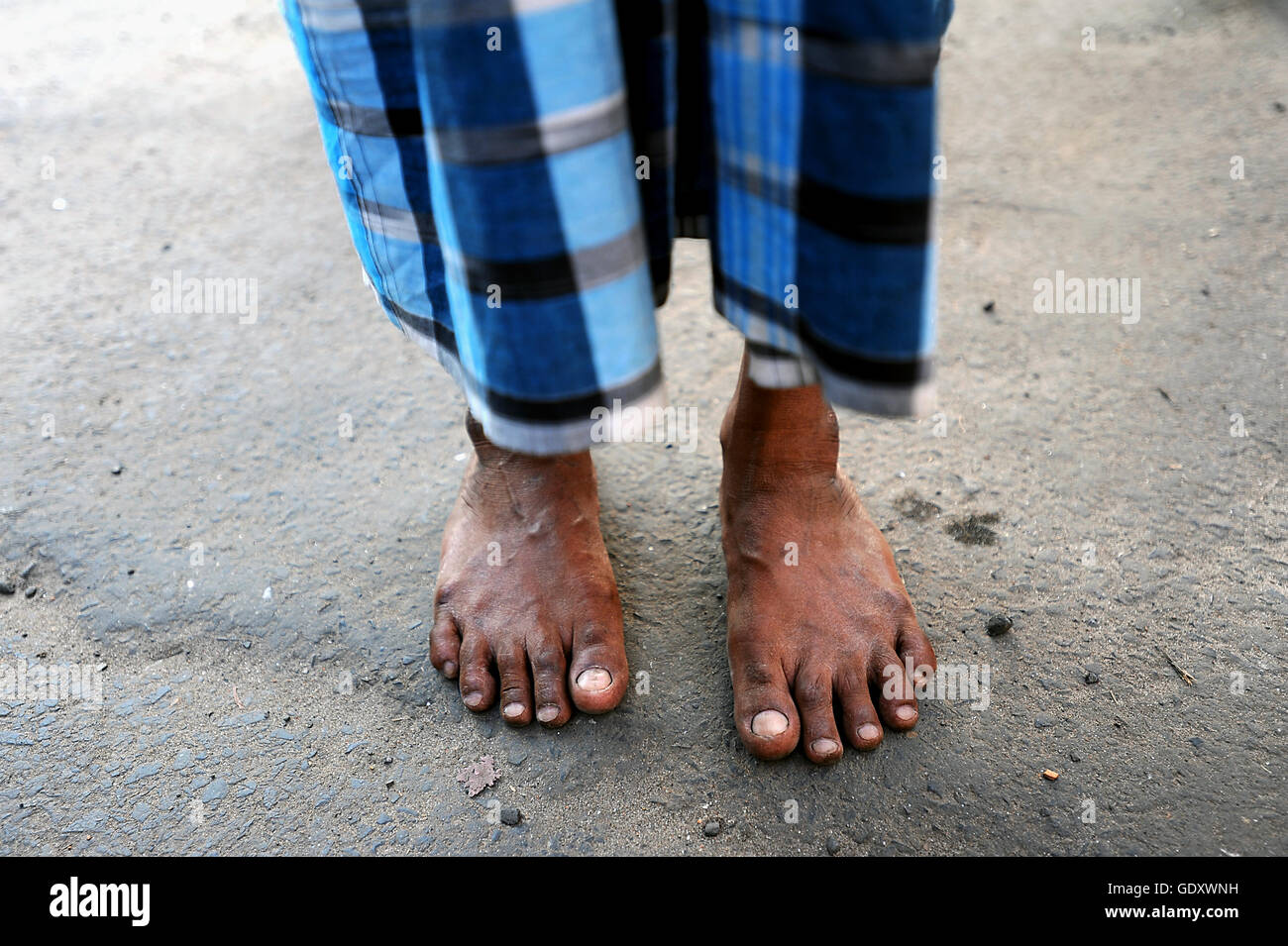 INDIA. Kolkata. 2011. Feet of a rickshaw puller Stock Photo - Alamy