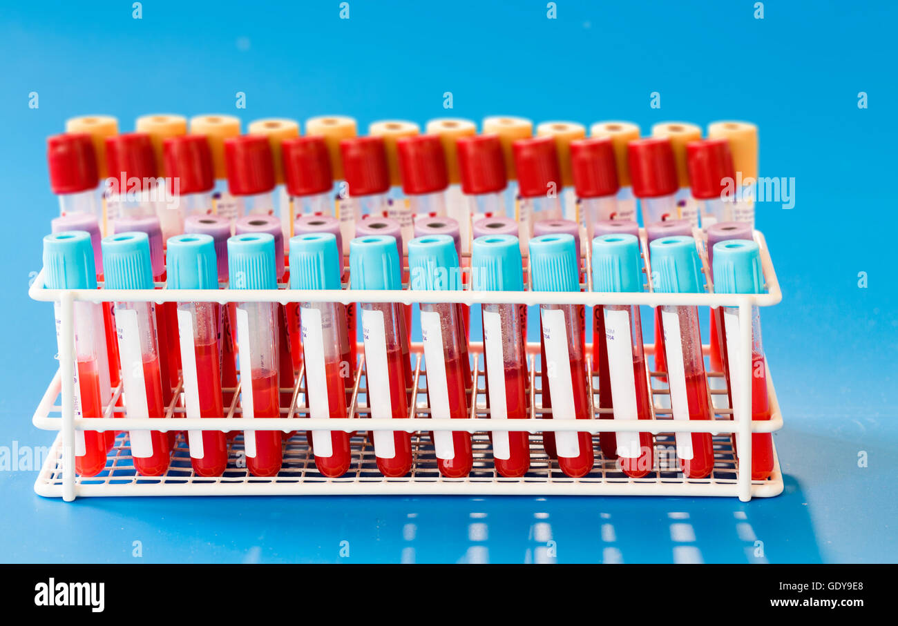 Blood sample in test tube Stock Photo - Alamy