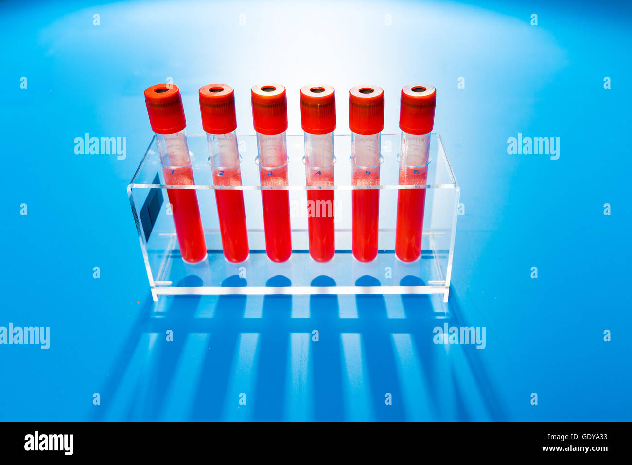 Blood sample in test tube Stock Photo - Alamy