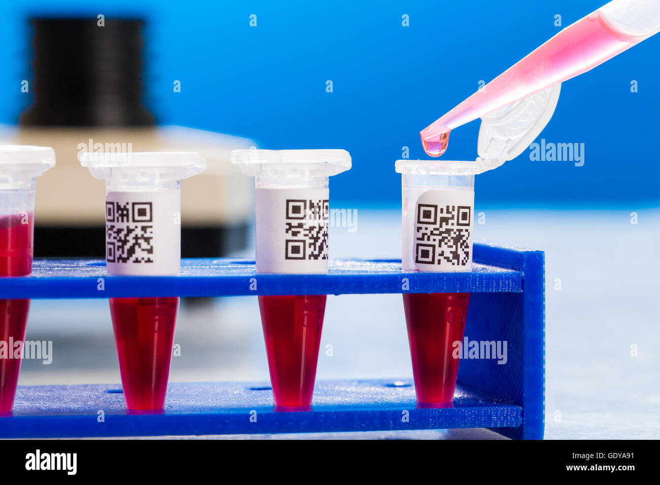 Blood test in medical laboratory, check sugar content diabetes risk ...