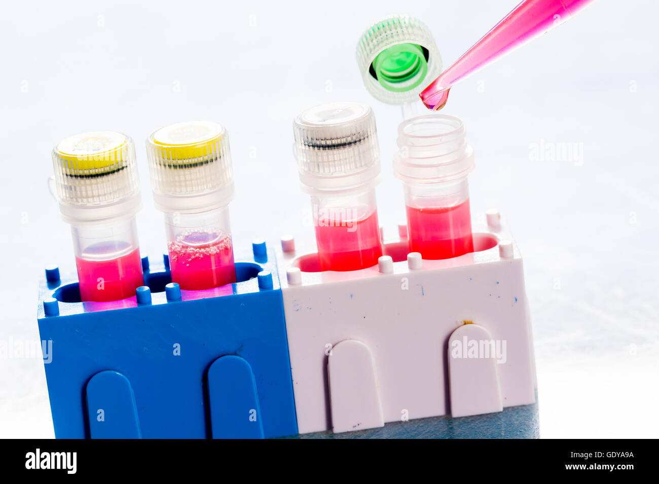 Blood test in medical laboratory, check sugar content diabetes risk ...