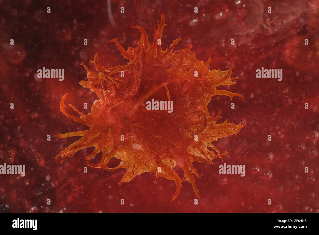 Magnification of a carcinoma cell Stock Photo - Alamy