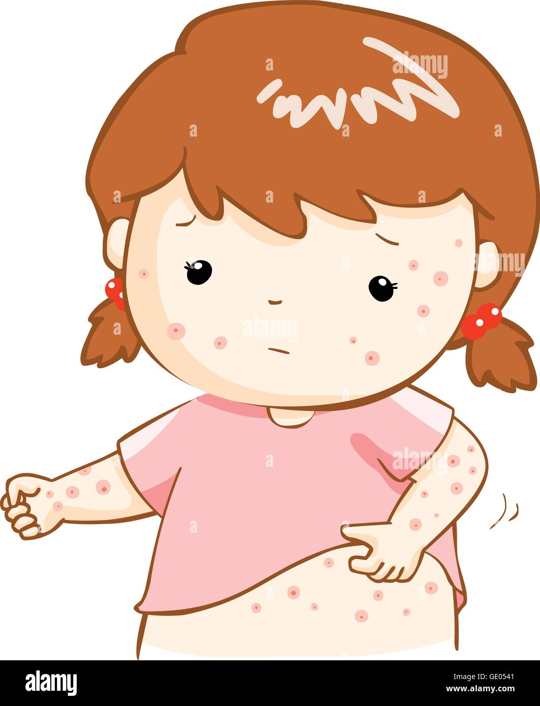 girl with health problem allergy rash itching vector Stock Vector Image ...