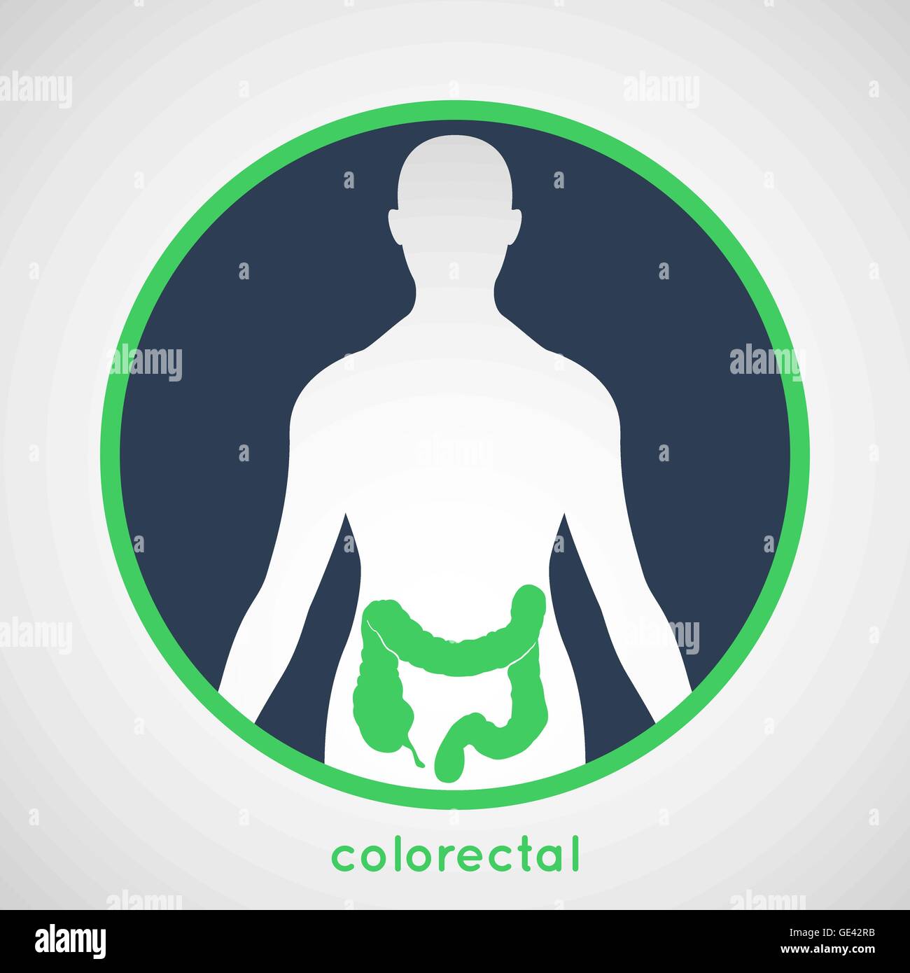 Colorectal cancer surgery Stock Vector Images - Alamy