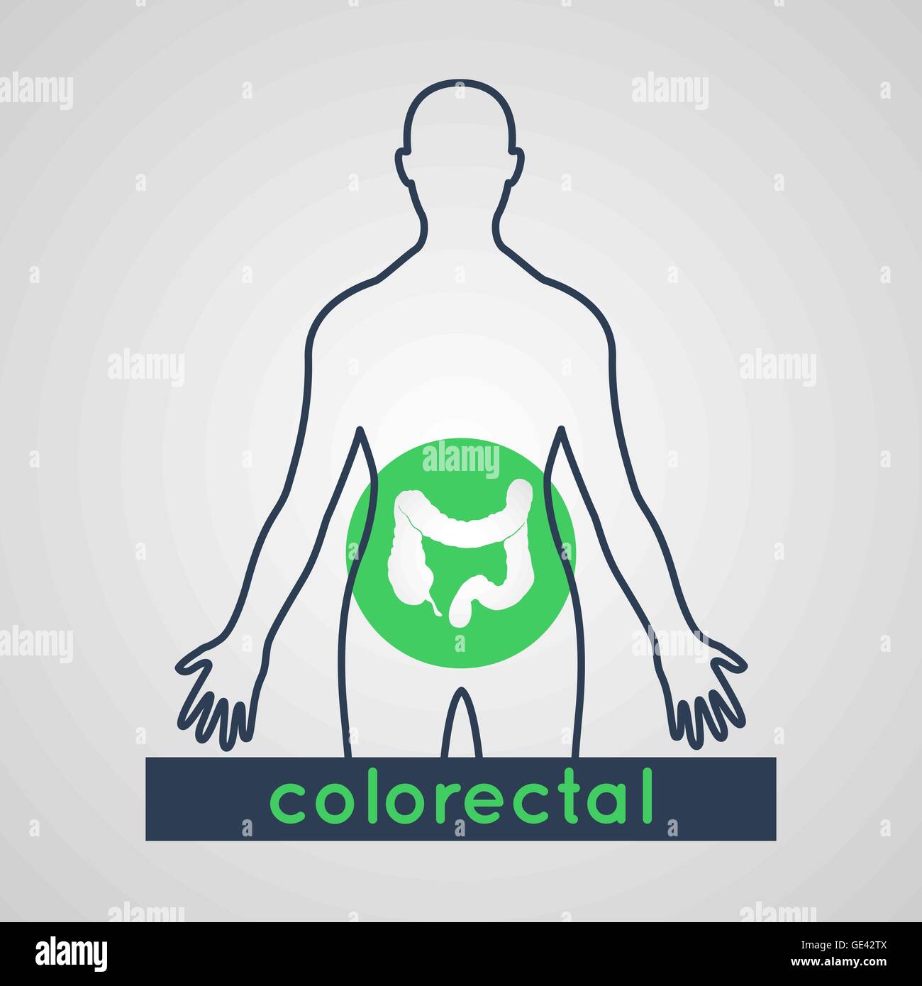 Colorectal cancer surgery Stock Vector Images - Alamy