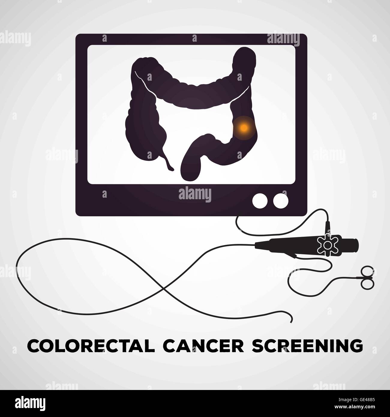 Colonoscopy procedure used for screening colon diseases Stock Vector ...