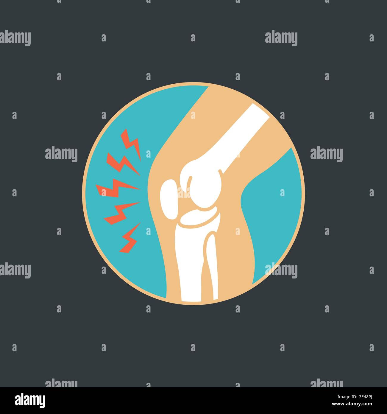 Knee joint replacement Stock Vector Images - Alamy
