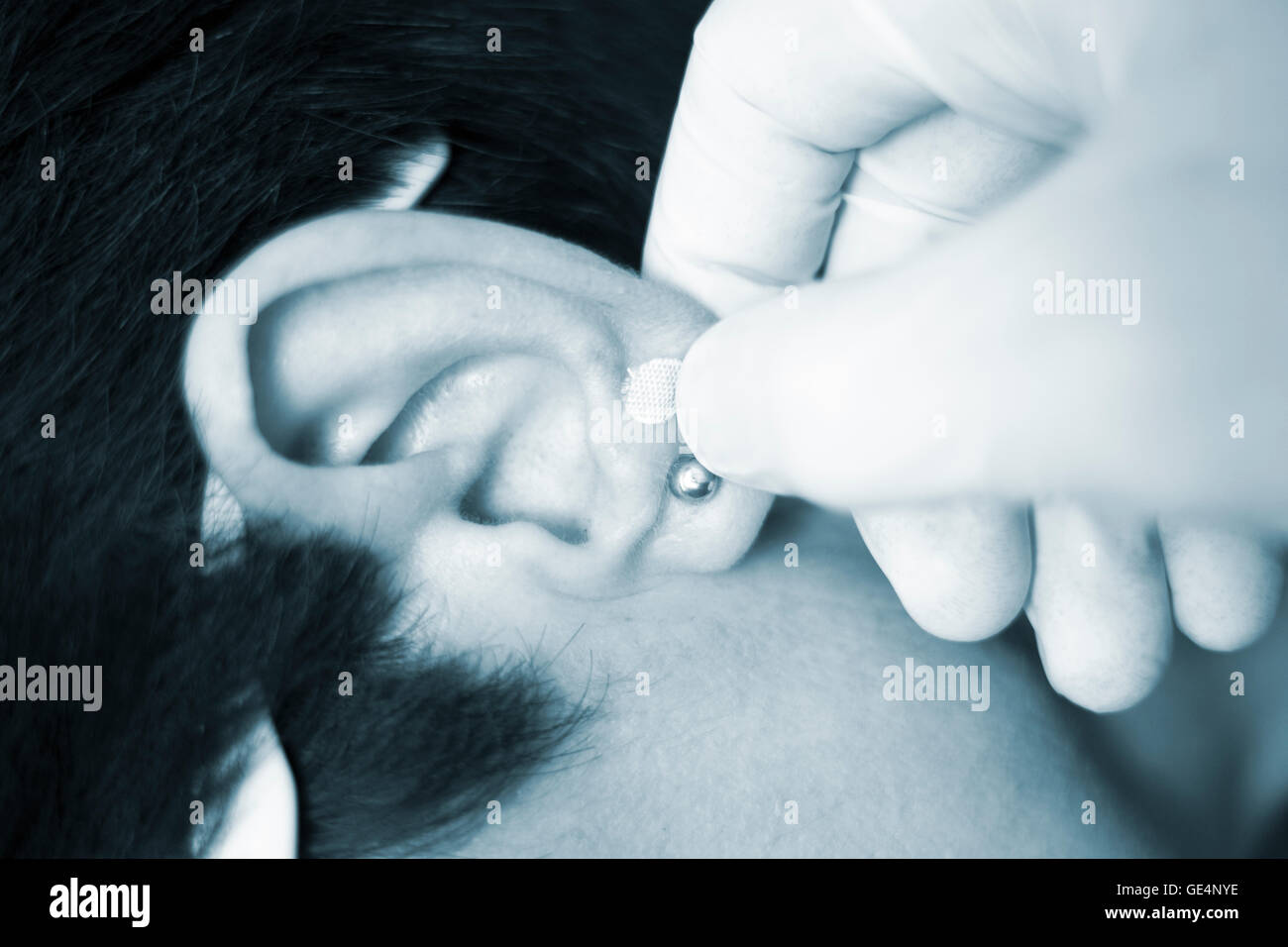 Auriculartherapy oriental acupunture ear seed sticker plaster ...