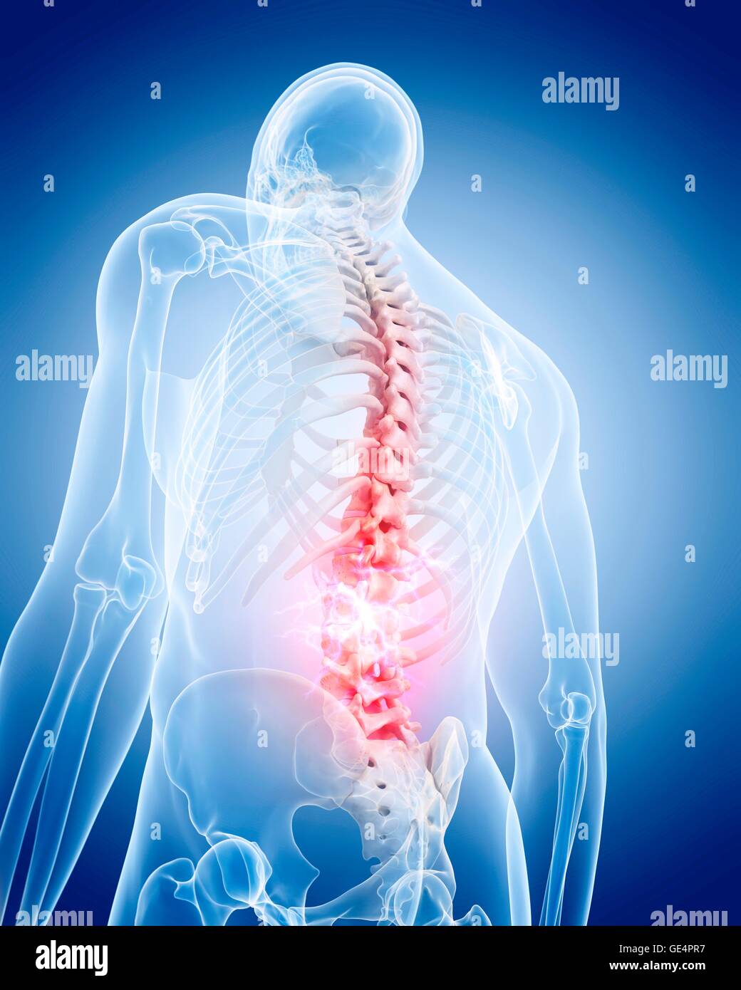 Science of pain illustration hi-res stock photography and images - Alamy