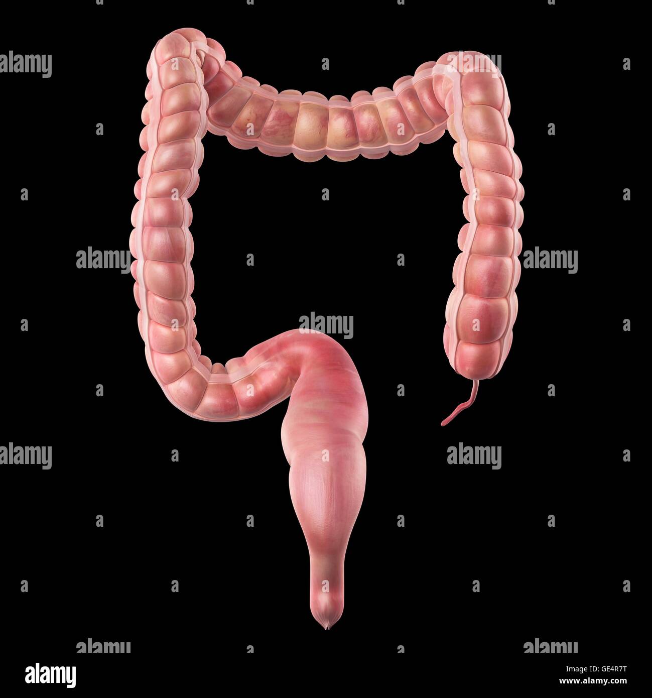 Human large intestine, illustration Stock Photo - Alamy