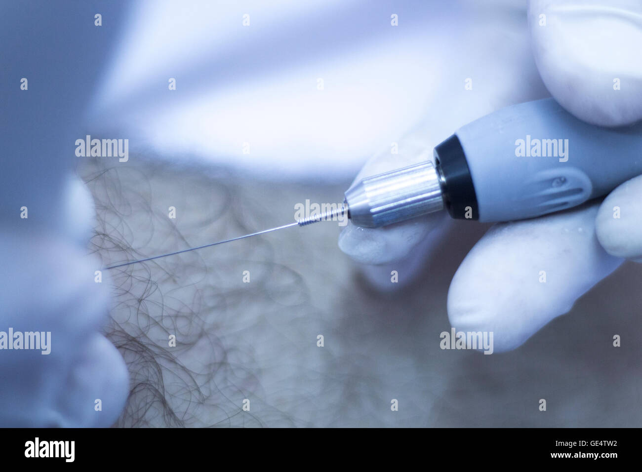 Electrólisis hi-res stock photography and images - Alamy