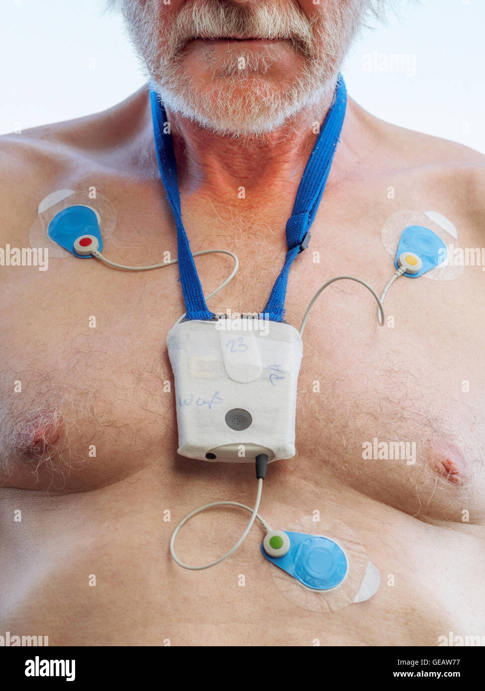 Ecg Stock Photos & Ecg Stock Images - Alamy