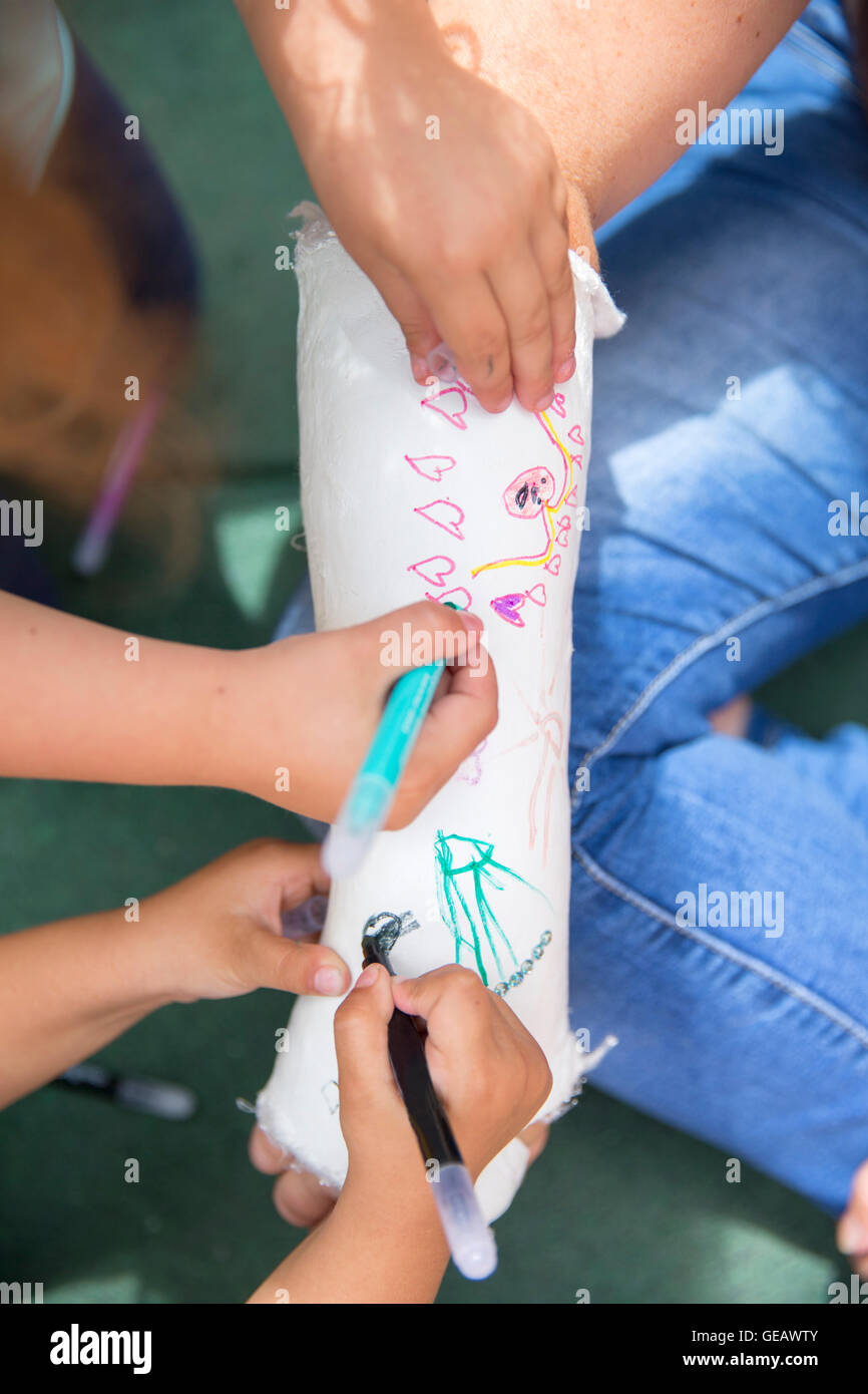 Little girls painting her mother's plaster arm Stock Photo - Alamy