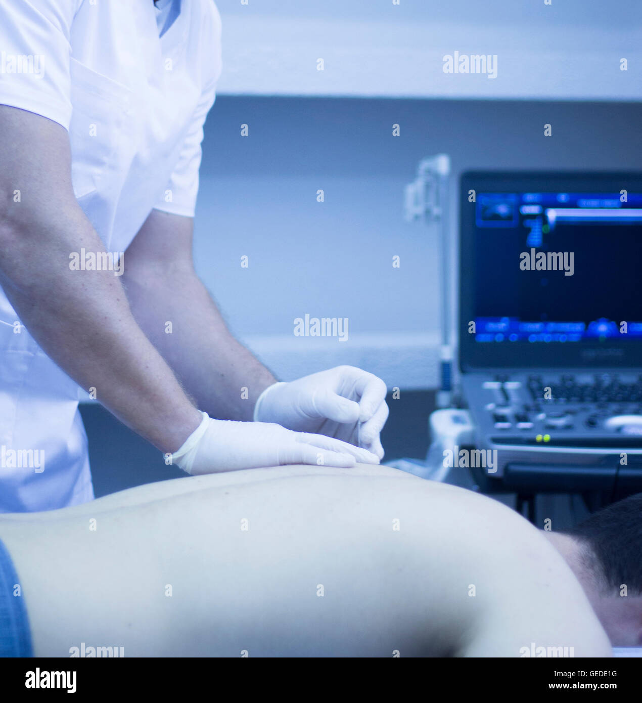 Percutaneous injection hi-res stock photography and images - Alamy