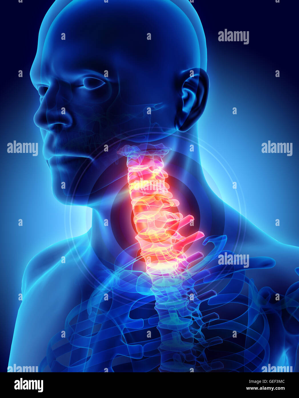 3D illustration, neck painful - cervica spine skeleton x-ray, medical ...