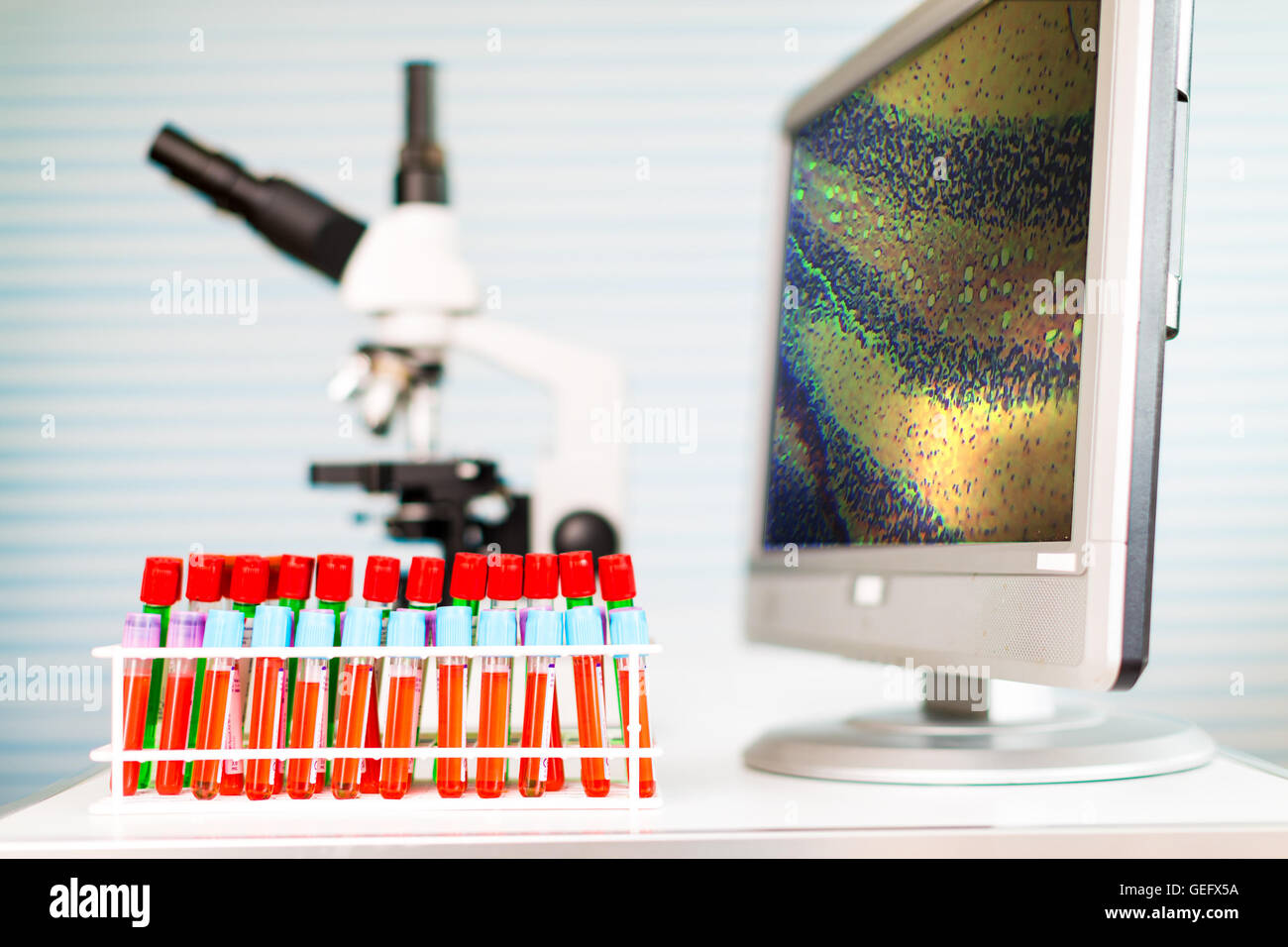 blood test in medical laboratory bench with microscope Stock Photo - Alamy