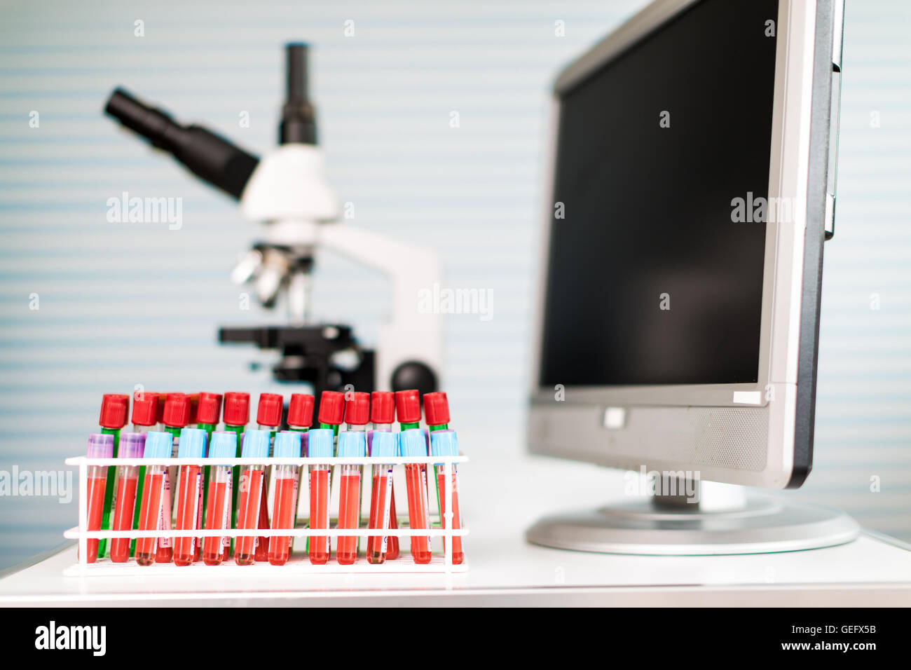 blood test in medical laboratory bench with microscope Stock Photo - Alamy