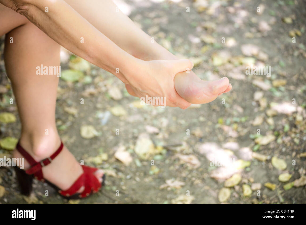Calluses hi-res stock photography and images - Alamy