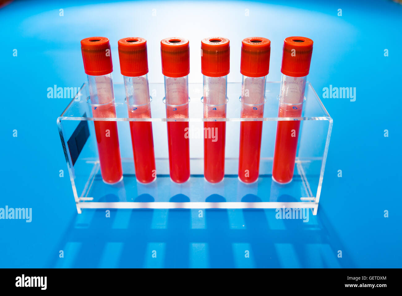 Blood sample in test tube Stock Photo - Alamy