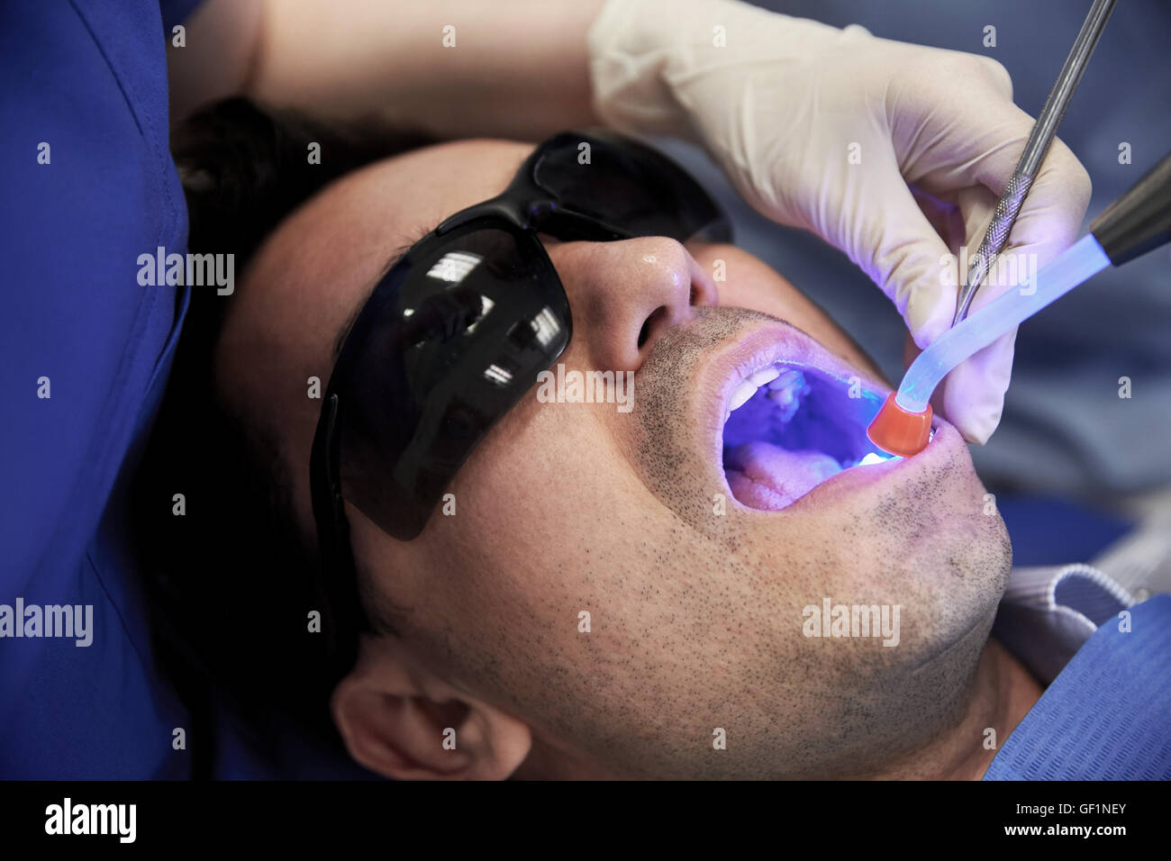 close up of male patient with dental curing light Stock Photo - Alamy