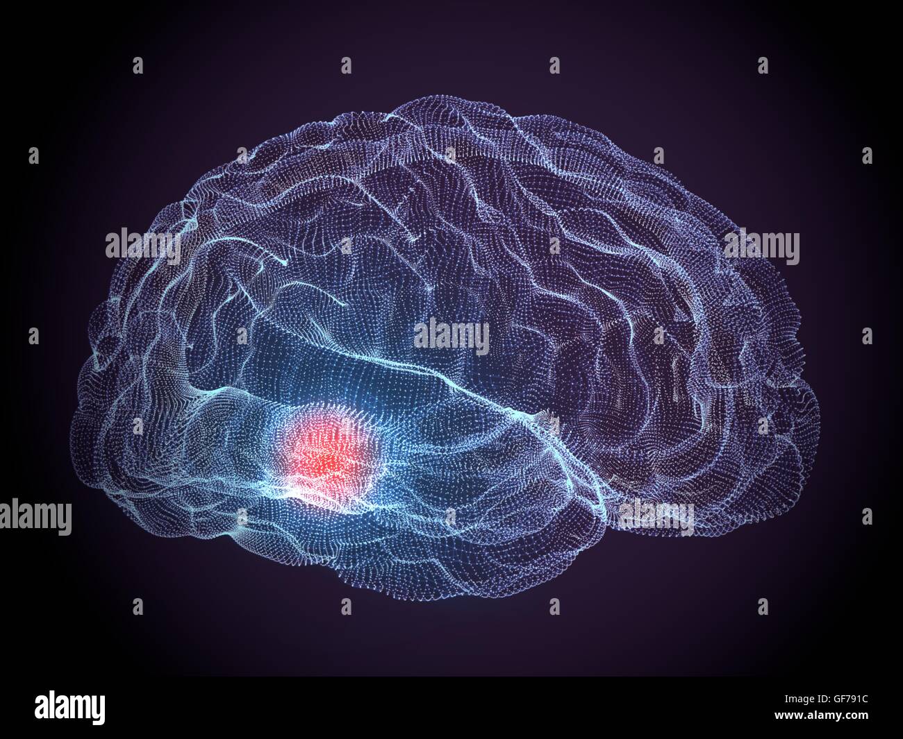 Brain degenerative diseases, Parkinson's, body, face Stock Photo - Alamy