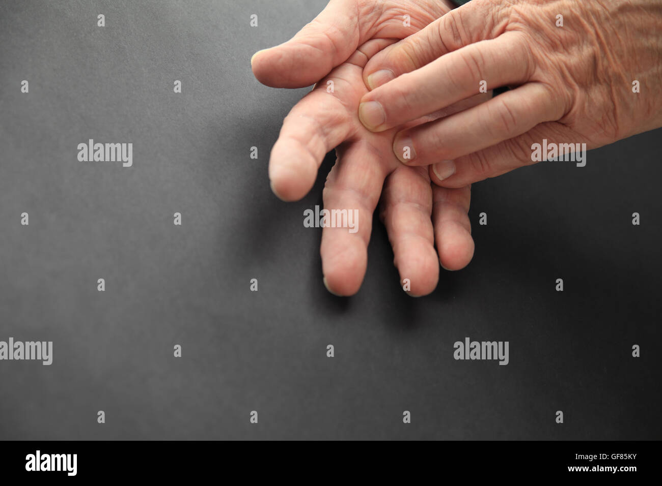Sore hands hi-res stock photography and images - Alamy