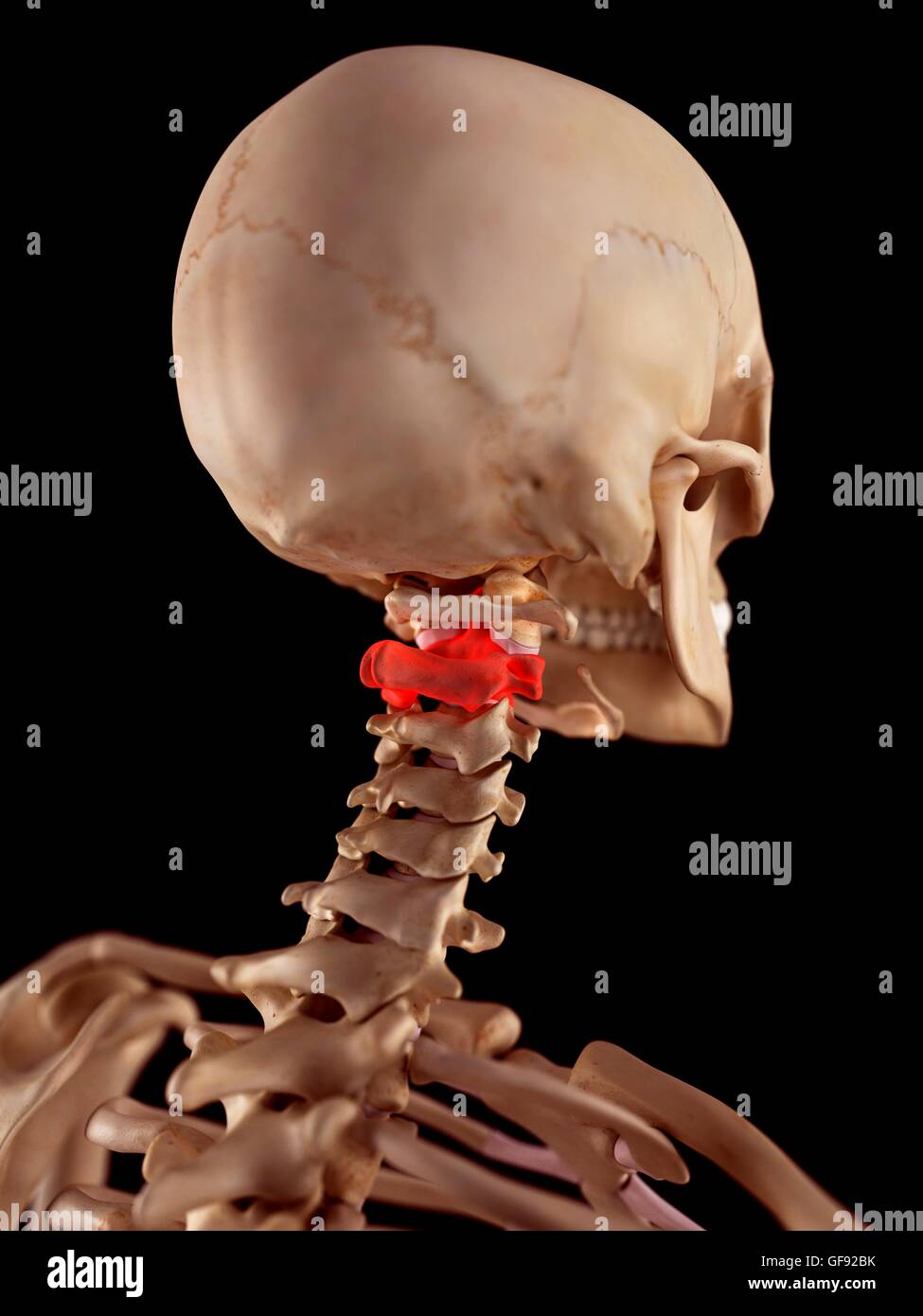 Human upper neck pain, illustration Stock Photo - Alamy