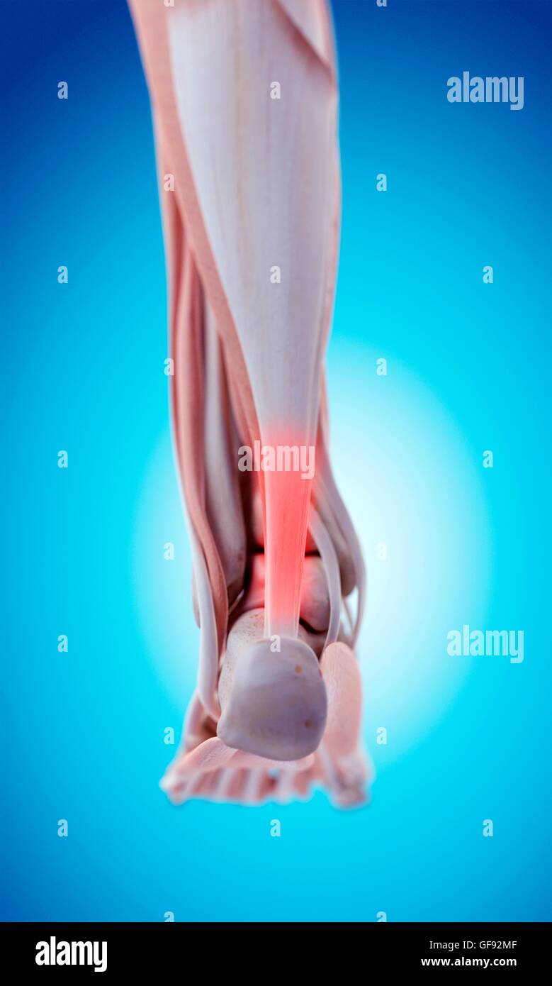Human foot pain, illustration Stock Photo - Alamy