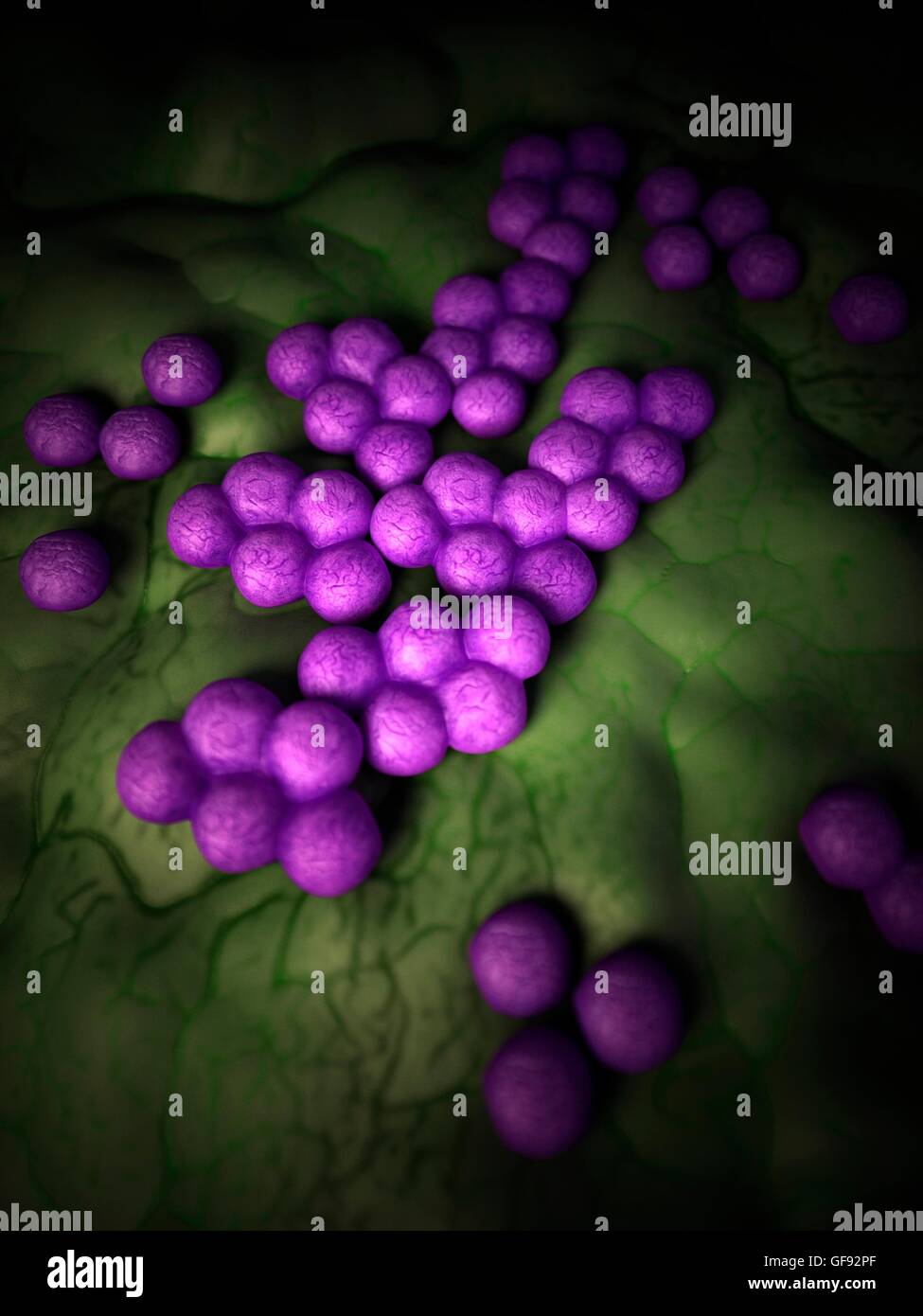Mrsa bacteria, illustration Stock Photo - Alamy