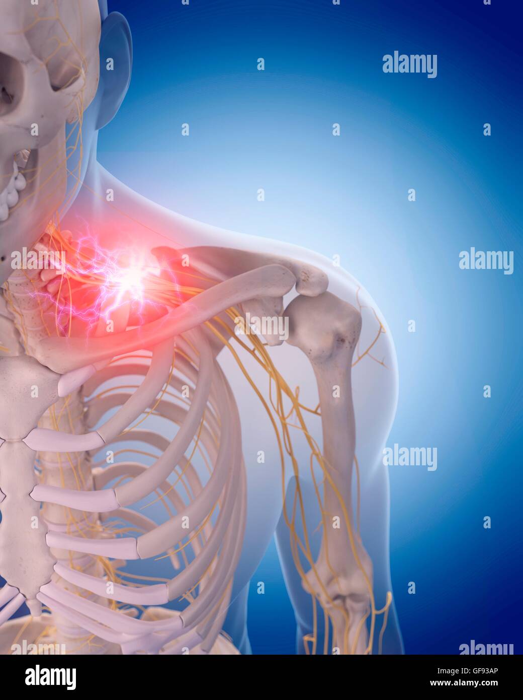 Human nerve pain, illustration Stock Photo - Alamy