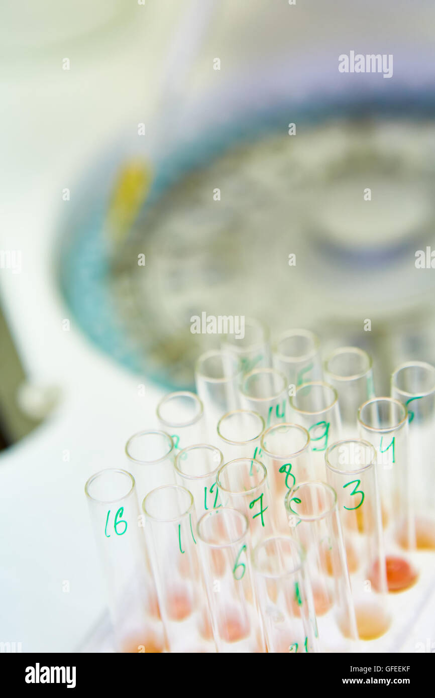 pipette dropping sample into a test tube,abstract science background ...