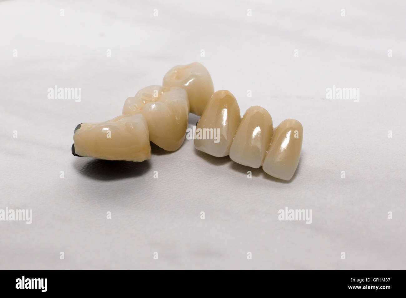 several dental metal-ceramic crowns on a white background Stock Photo ...