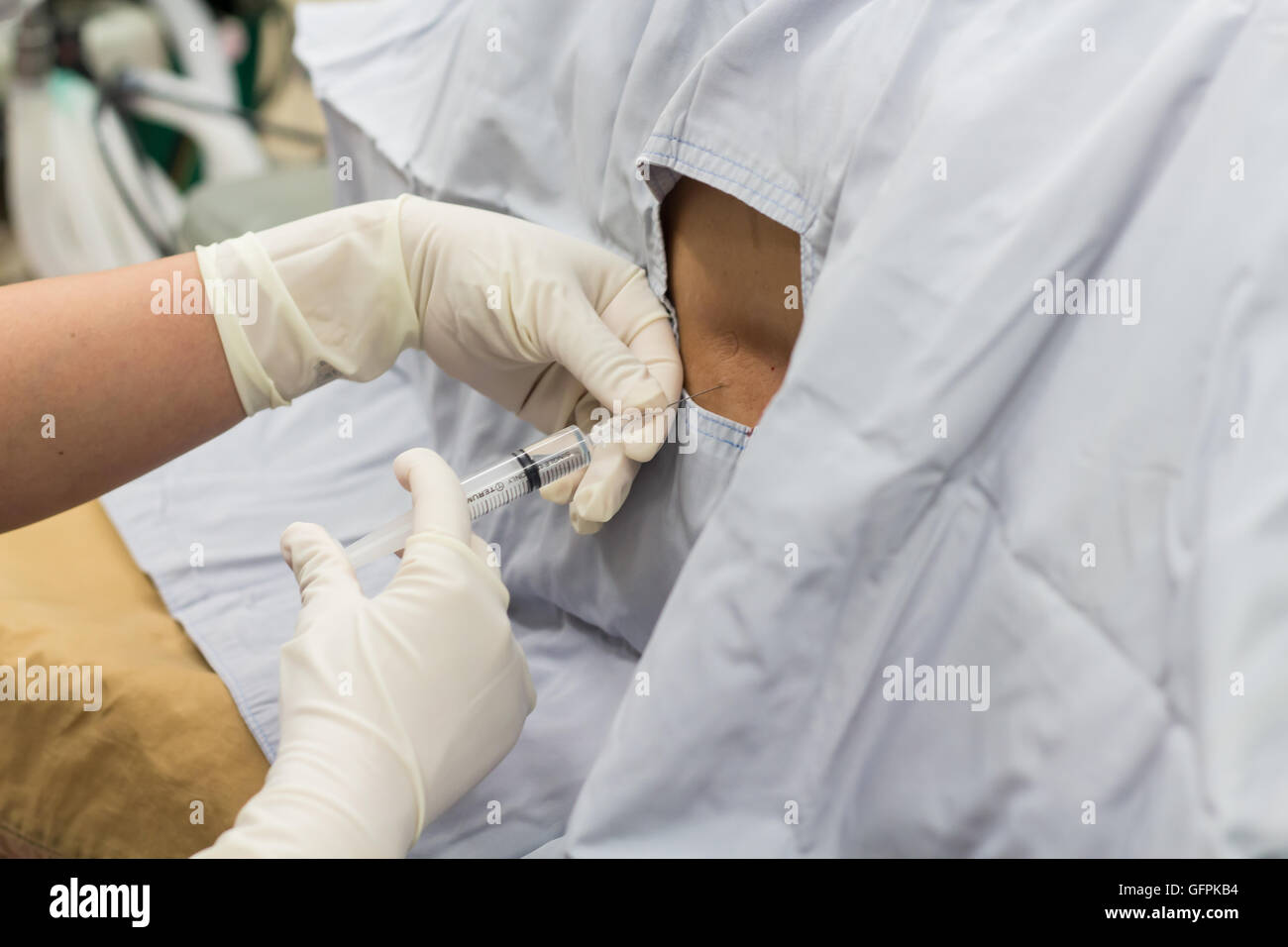 Nerve block hi-res stock photography and images - Alamy