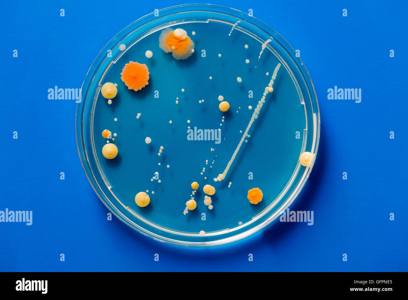 Petri Dish Bacteria Identification