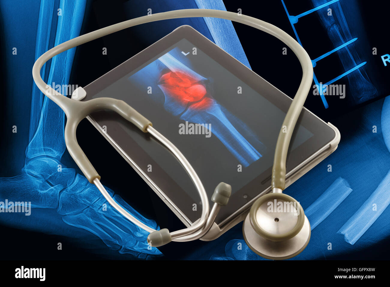 Modern medical tablet on x-rays images background Stock Photo - Alamy