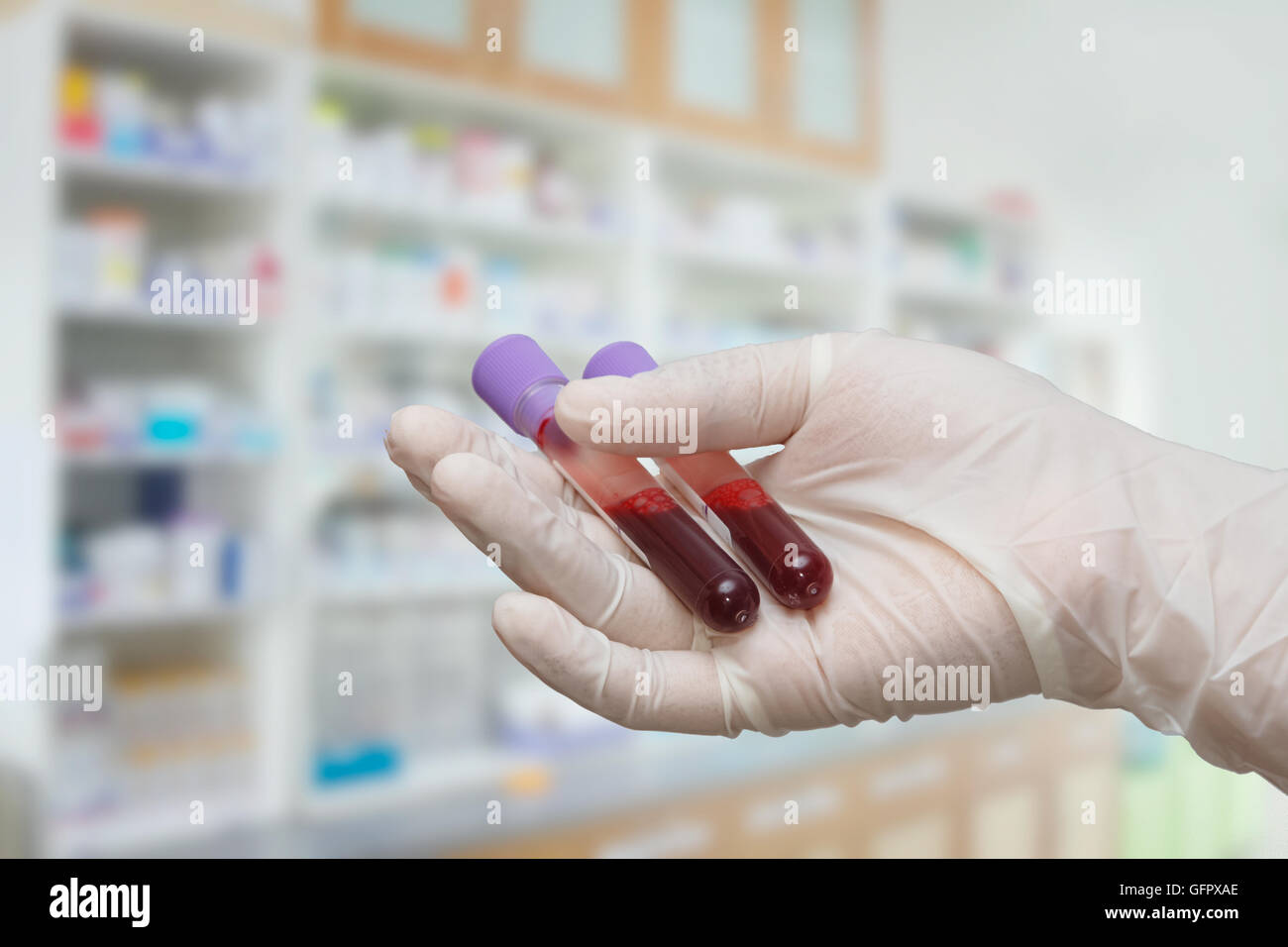 Hand holding test tube with blood sample Stock Photo - Alamy