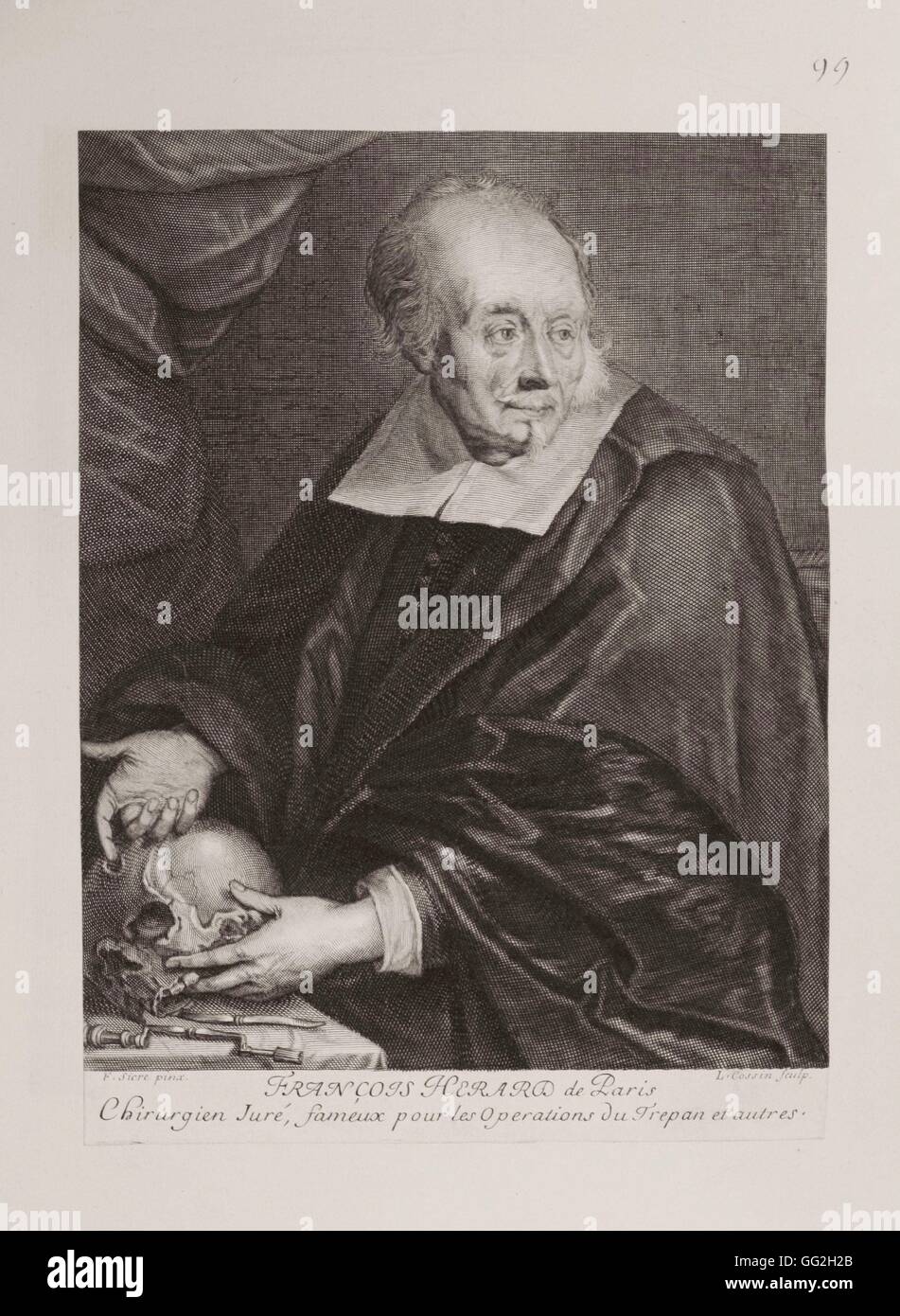 Trepanation of the skull hi-res stock photography and images - Alamy
