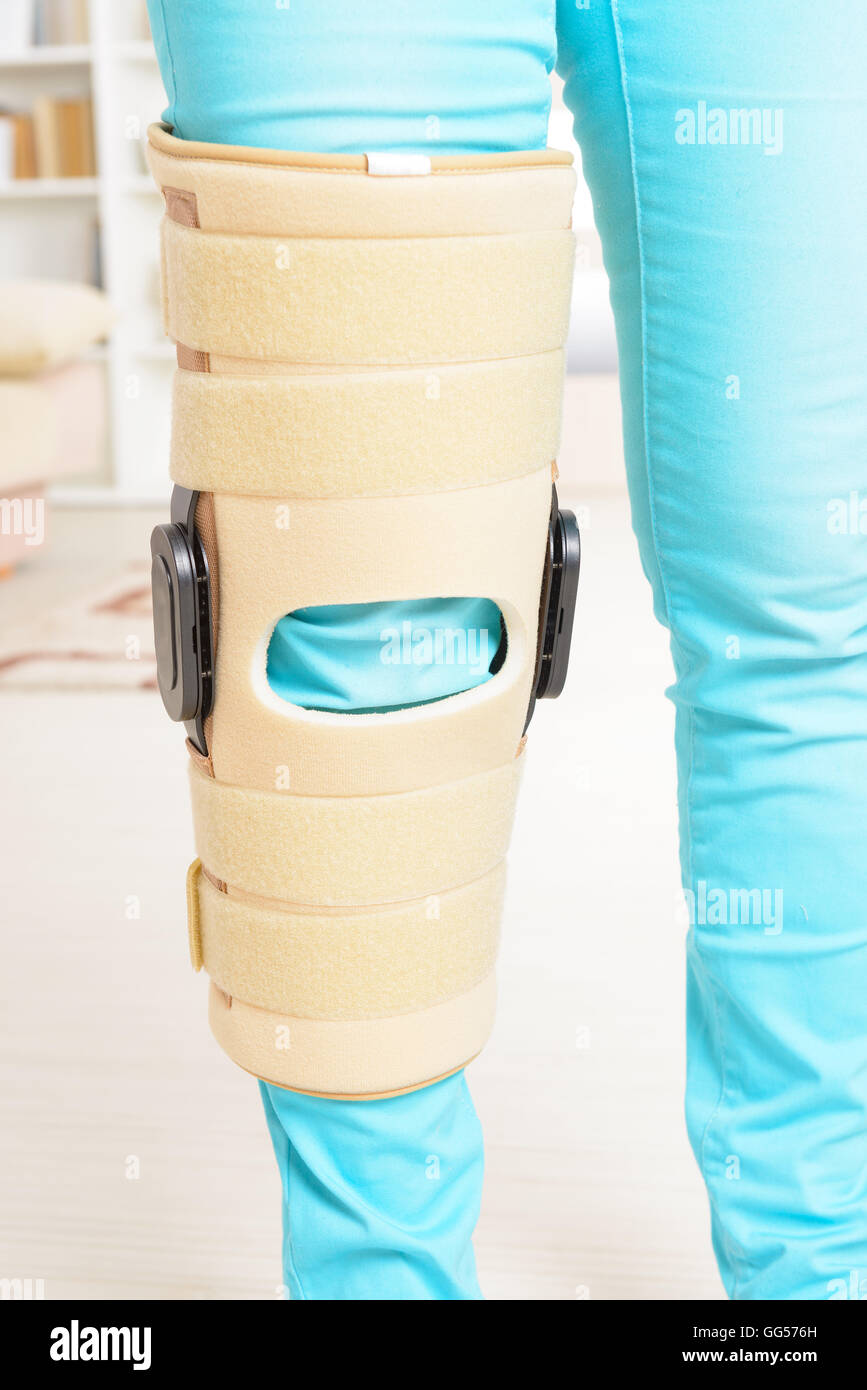 Woman's leg in knee cages for stabilization and support Stock Photo - Alamy